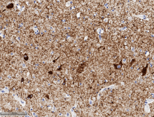 Multiplex IHC - Indica Labs