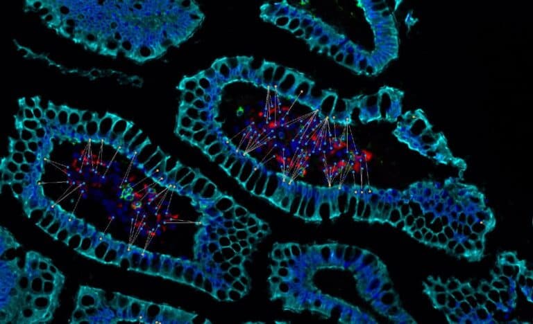 Quantitative Digital Pathology: An Overview of the HALO® Image Analysis ...