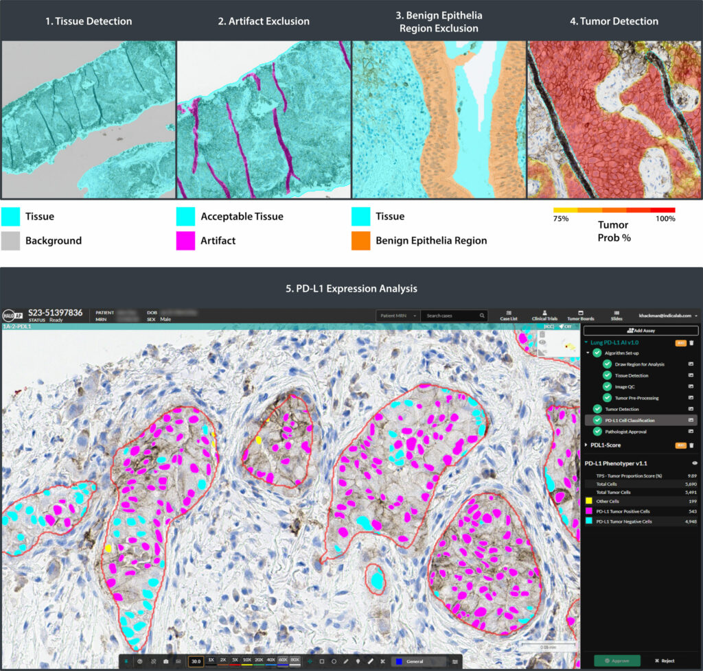 Lung PD-L1 AI - Indica Labs