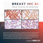 Breast IHC AI - Indica Labs