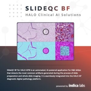 Breast IHC AI - Indica Labs
