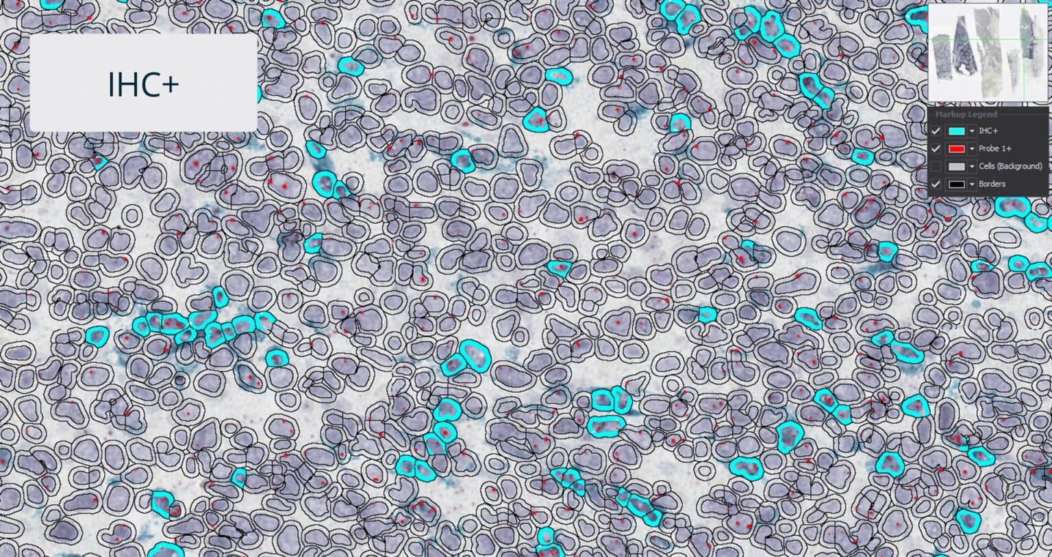AI-Powered Pathology - Indica Labs AI-Powered Pathology