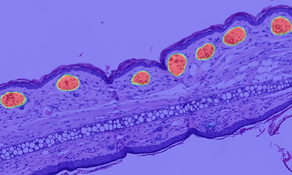 HALO AI | Trainable AI for Pathology - Indica Labs
