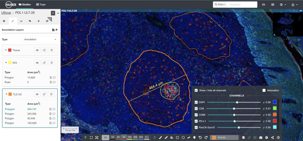 HALO Link | Collaborative Image Management for Pathology - Indica Labs