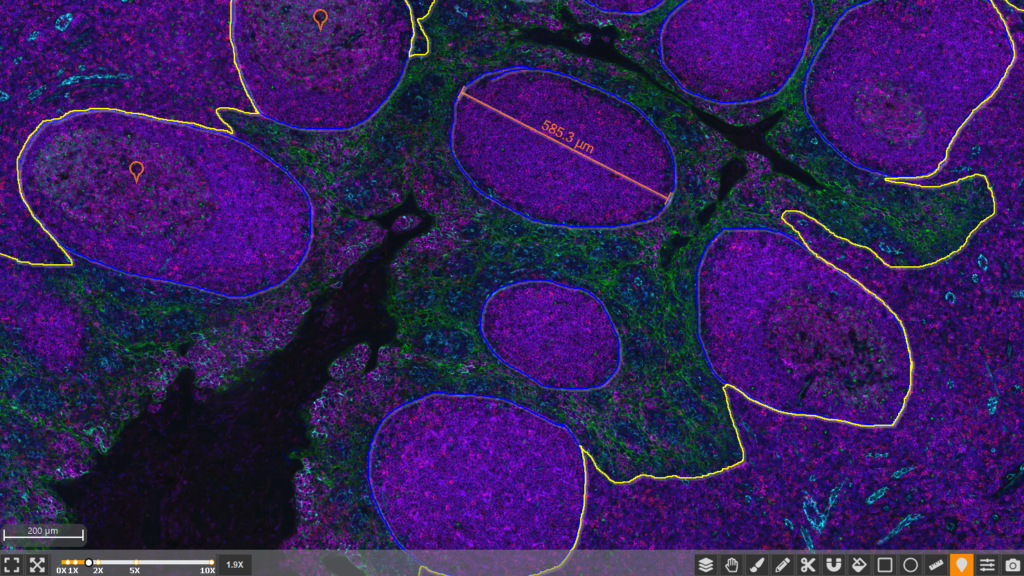 HALO | Quantitative Image Analysis for Pathology - Indica Labs