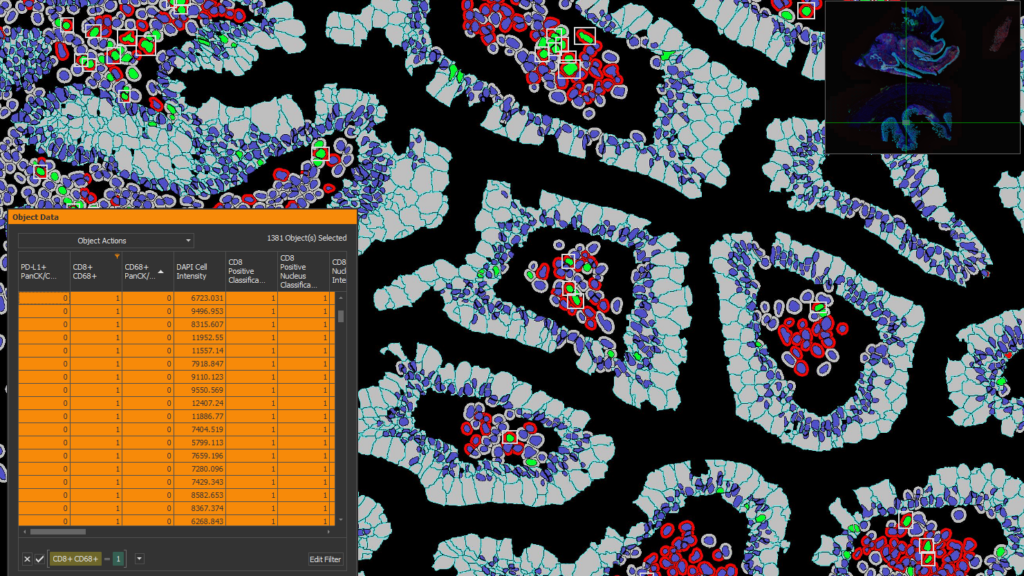 HALO | Quantitative Image Analysis for Pathology - Indica Labs