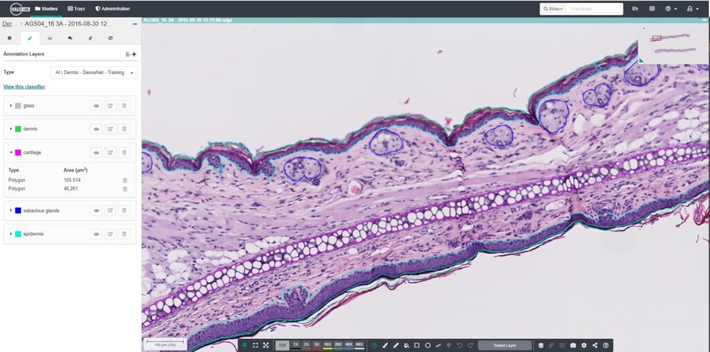 HALO AI | Trainable AI for Pathology - Indica Labs