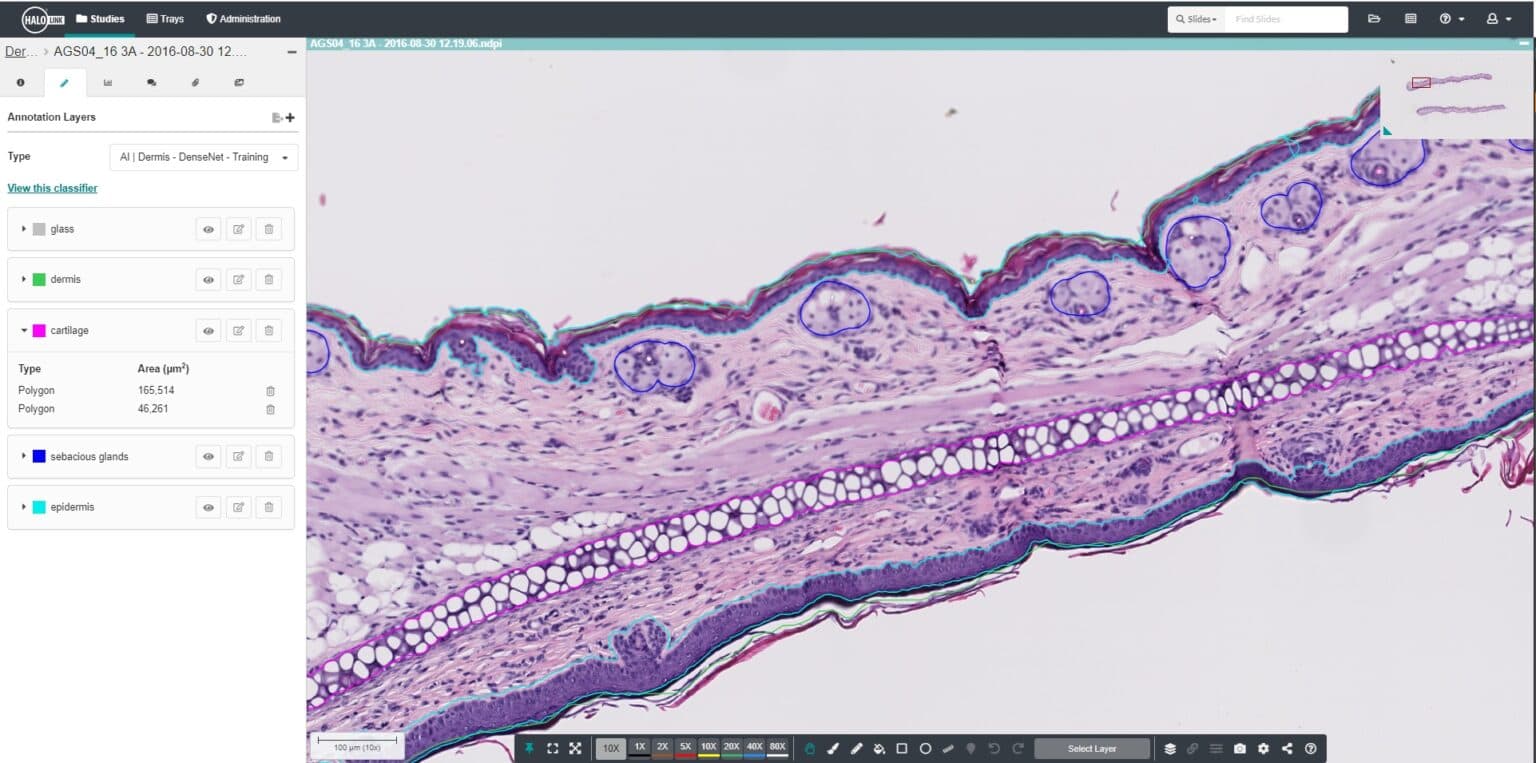 HALO AI | Trainable AI for Pathology - Indica Labs