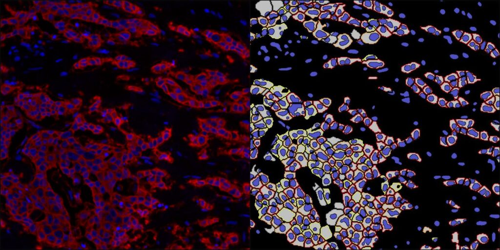 HALO | Quantitative Image Analysis for Pathology - Indica Labs