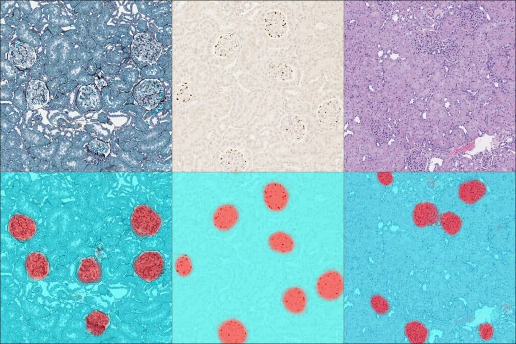 HALO AI | Trainable AI for Pathology - Indica Labs