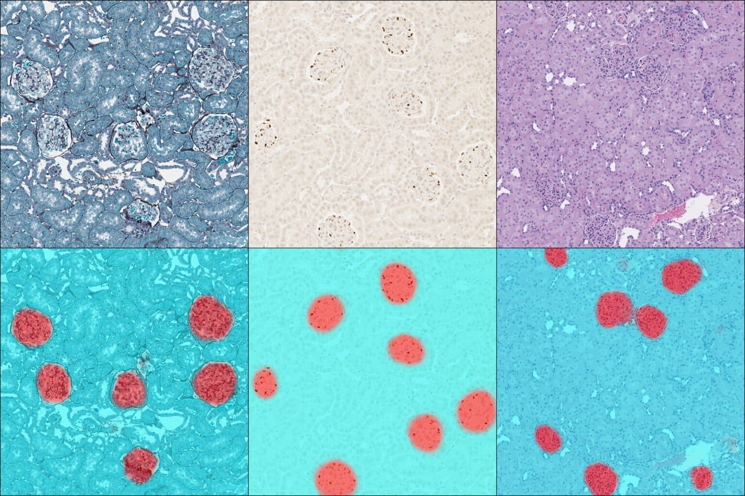 HALO AI | Trainable AI for Pathology - Indica Labs