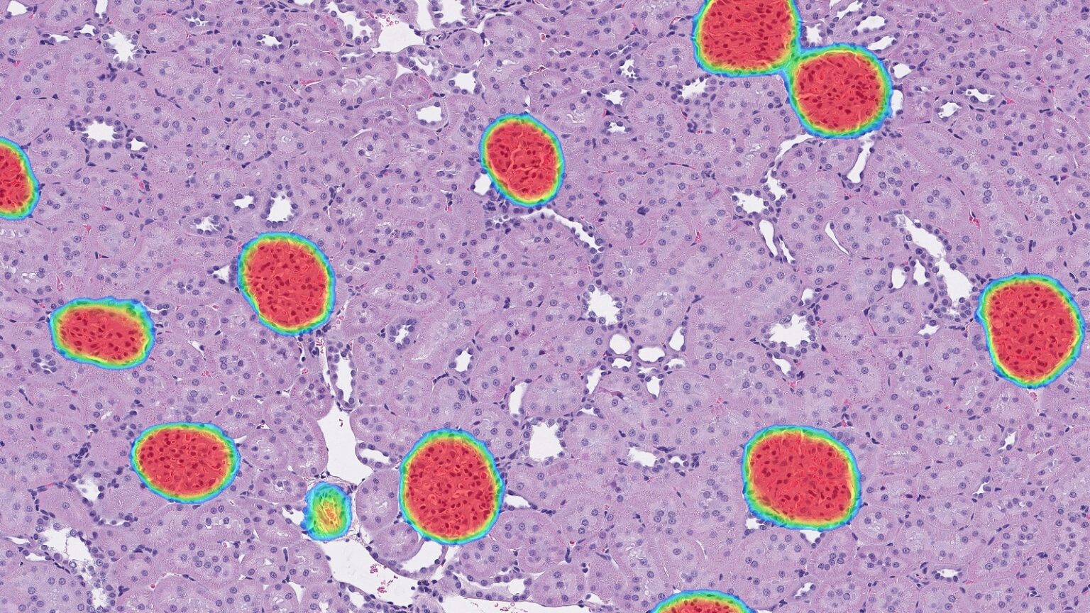 HALO AI | Trainable AI for Pathology - Indica Labs