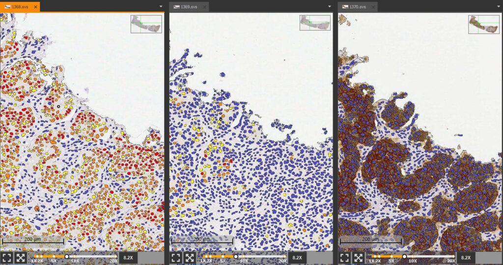 HALO | Quantitative Image Analysis for Pathology - Indica Labs
