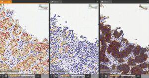 HALO | Quantitative Image Analysis for Pathology - Indica Labs