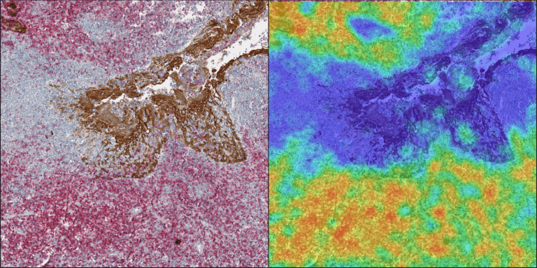 HALO | Quantitative Image Analysis for Pathology - Indica Labs