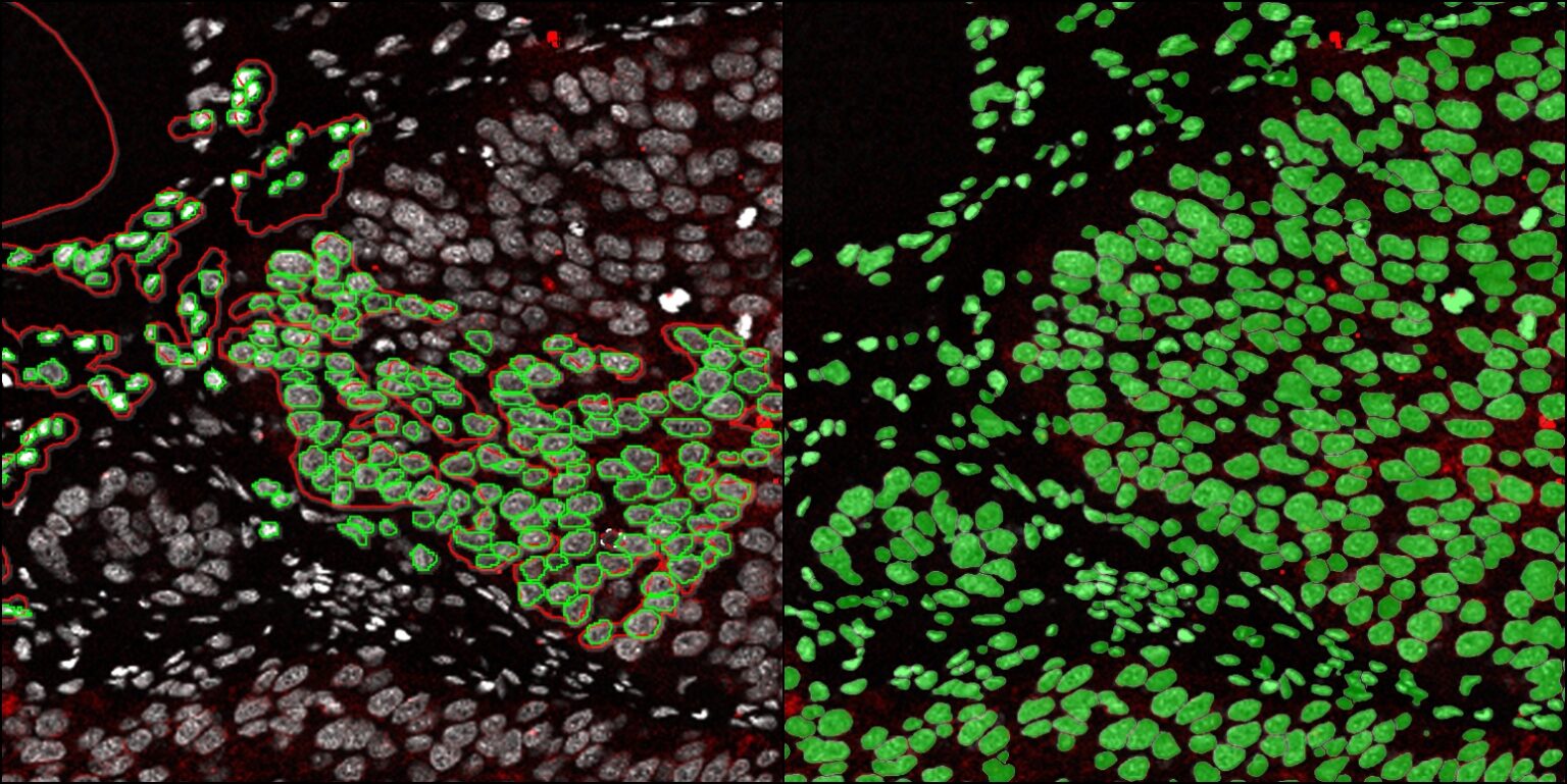 HALO AI | Trainable AI for Pathology - Indica Labs