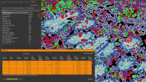 HALO | Quantitative Image Analysis for Pathology - Indica Labs