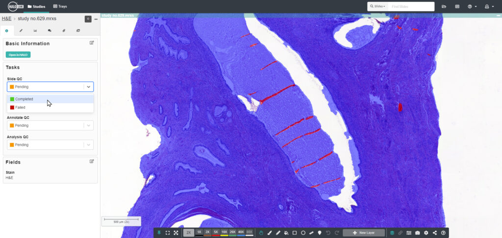 HALO Link | Collaborative Image Management for Pathology - Indica Labs