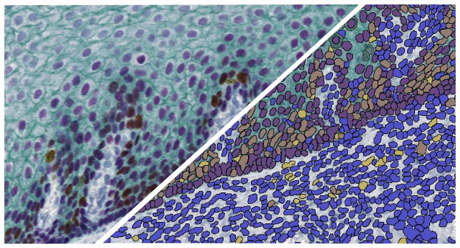 Multiplex IHC - Indica Labs