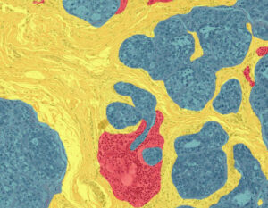 HALO Link | Collaborative Image Management for Pathology - Indica Labs