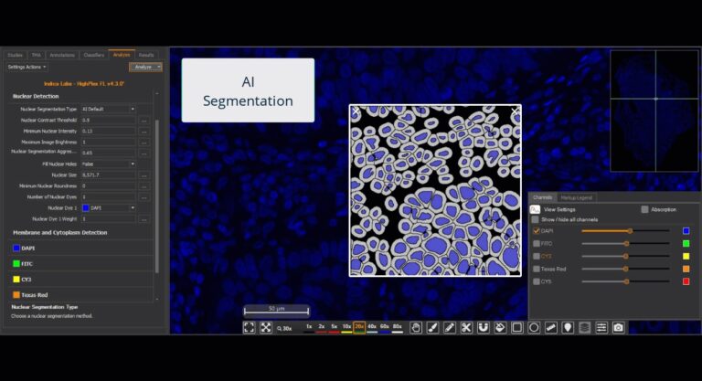 AI-Powered Pathology - Indica Labs AI-Powered Pathology