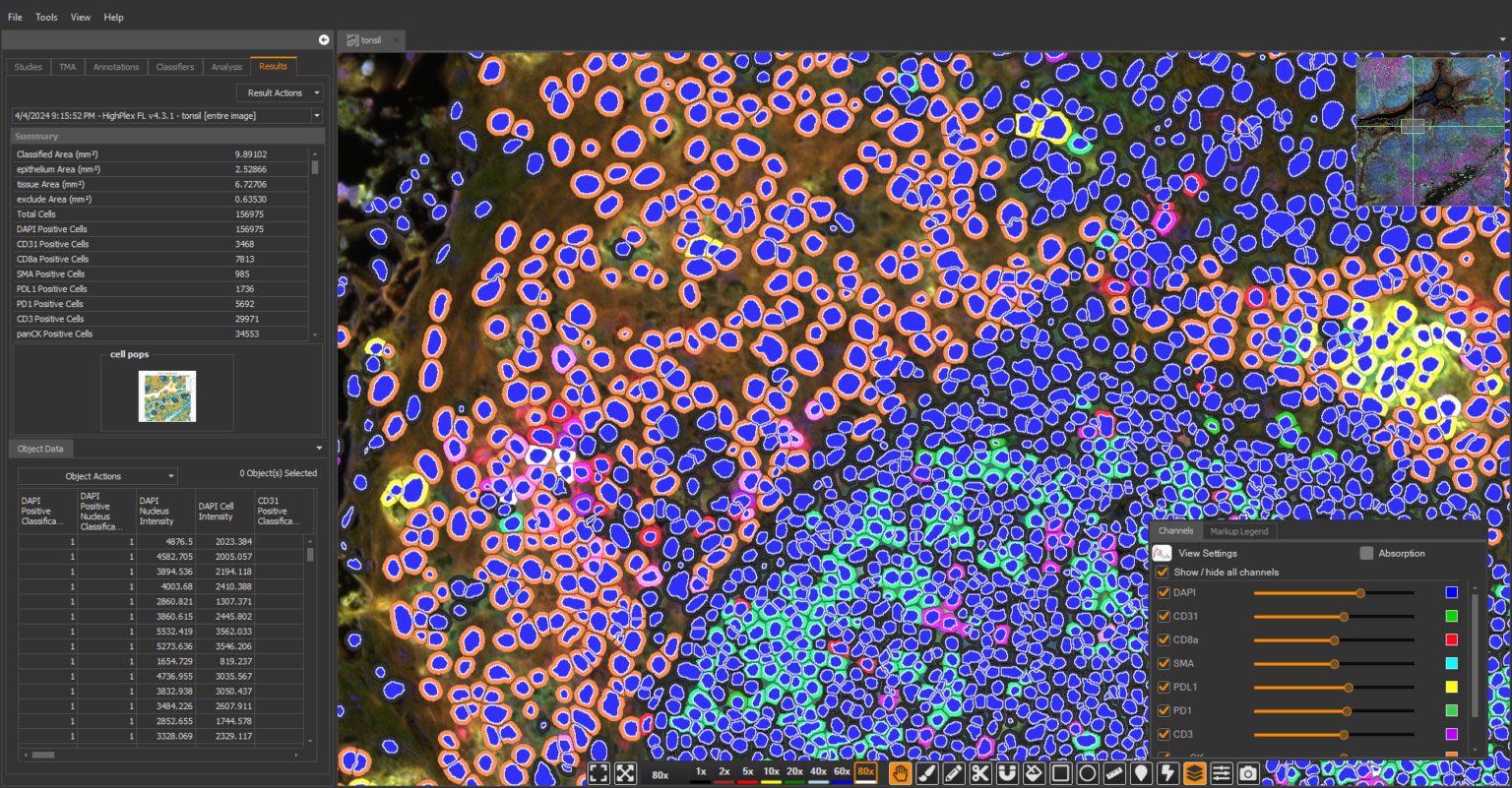 HALO AI | Trainable AI for Pathology - Indica Labs