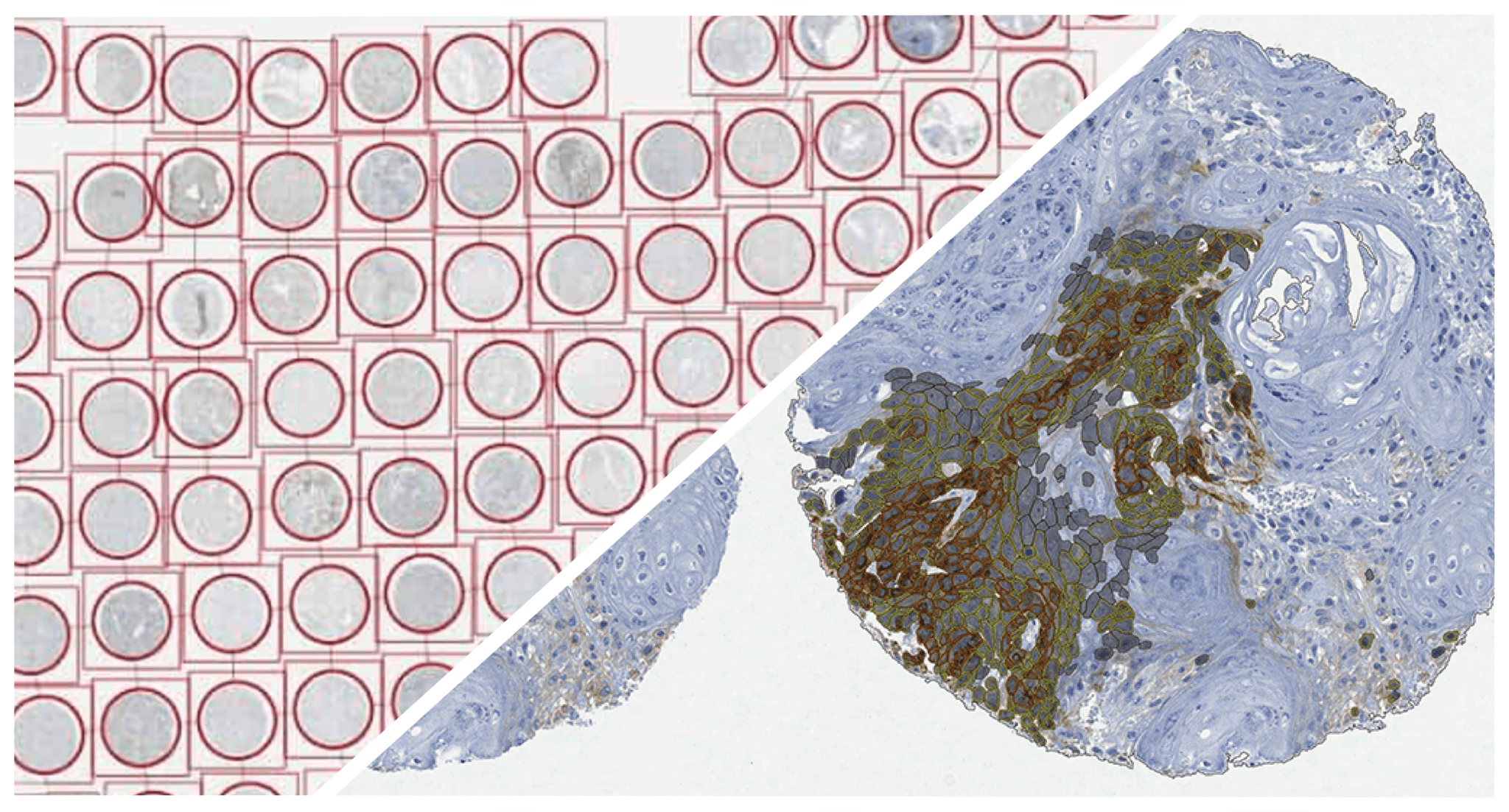 TMA (Tissue Microarray) Add-On - Indica Labs