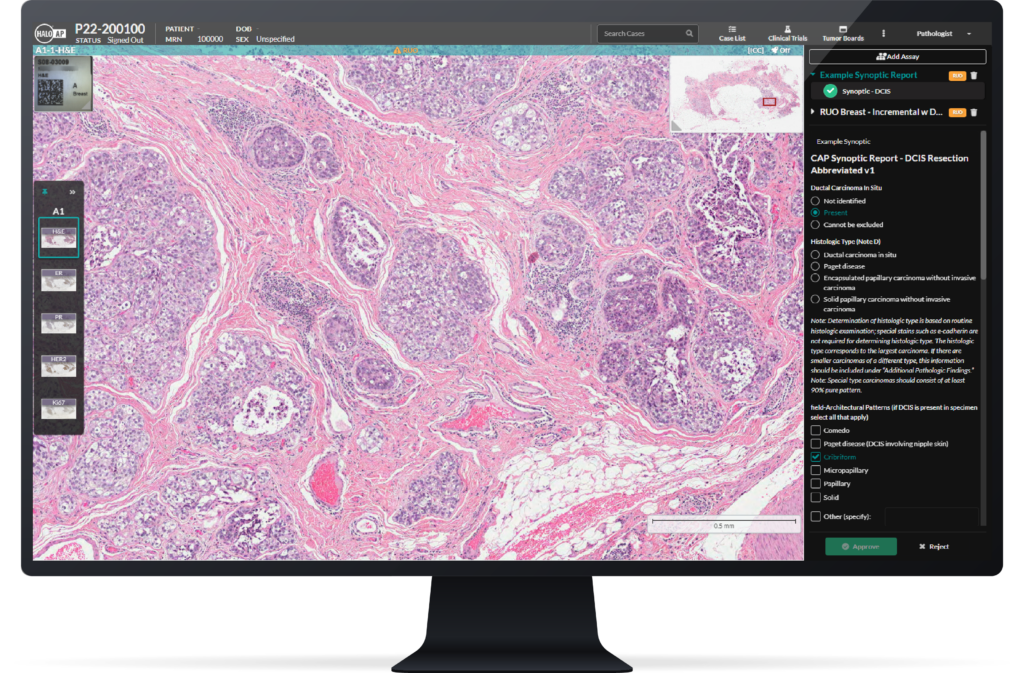 HALO AP® - Indica Labs