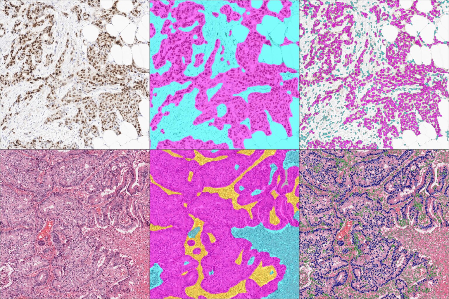 Multiplex IHC - Indica Labs