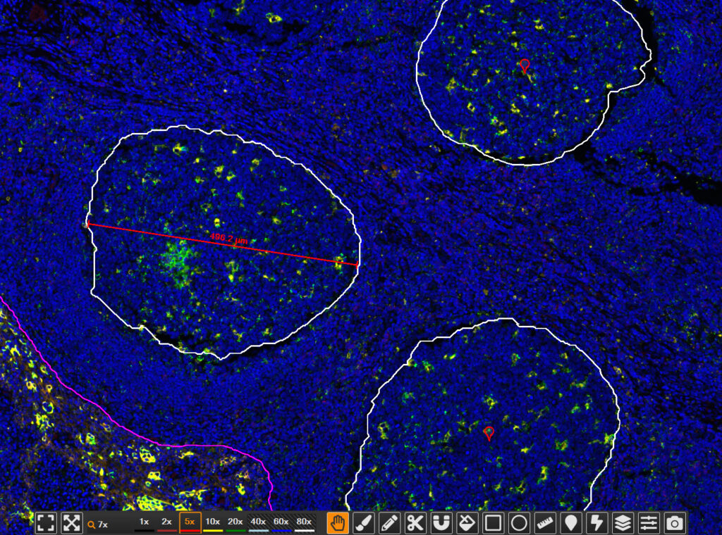 HALO | Quantitative Image Analysis for Pathology - Indica Labs
