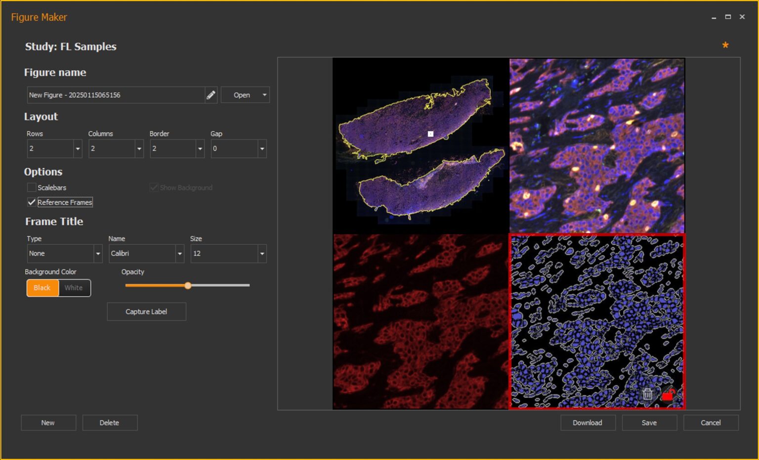 HALO | Quantitative Image Analysis for Pathology - Indica Labs