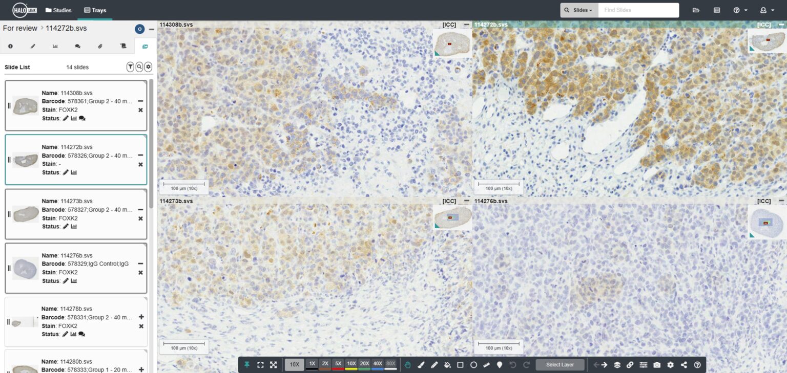 HALO Link | Collaborative Image Management for Pathology - Indica Labs