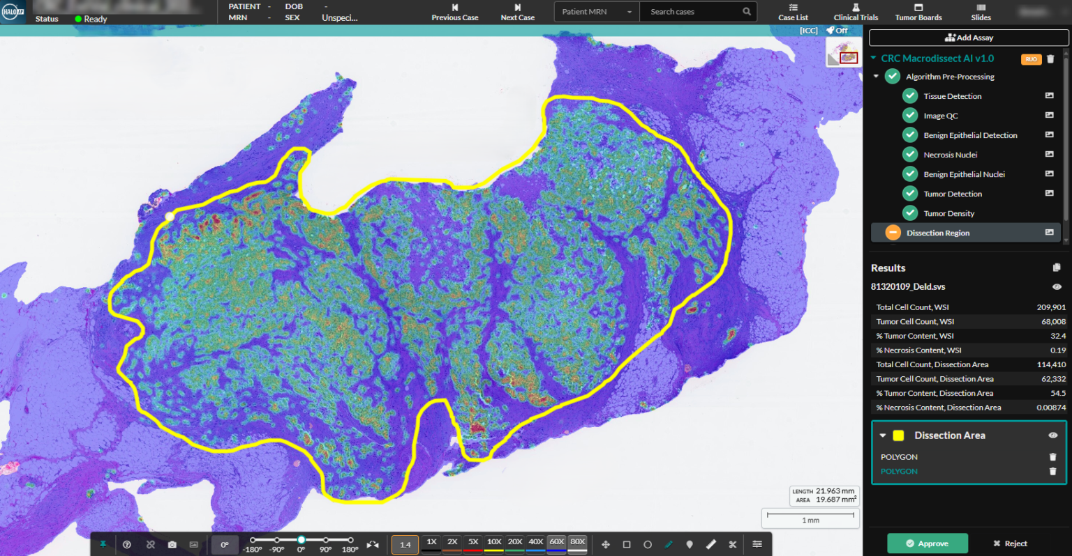 AI-Powered Pathology - Indica Labs AI-Powered Pathology