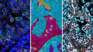 Getting Started with Multiplex Fluorescence Image Analysis in HALO ...